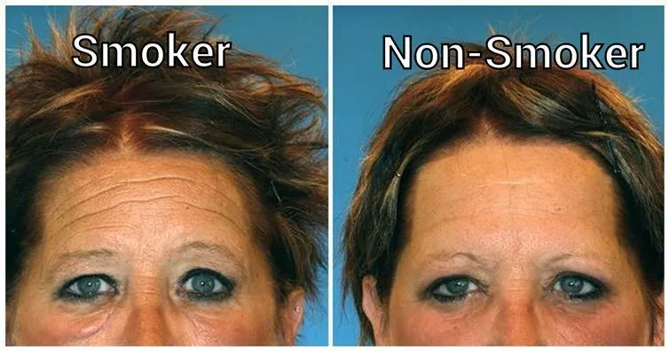 Devinez lesquels de ces jumeaux sont fumeurs... (photos)