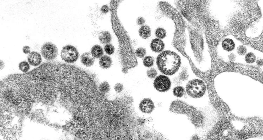 EVASION - La présence d'un virus extrêmement rare confirmée en Île-de ...